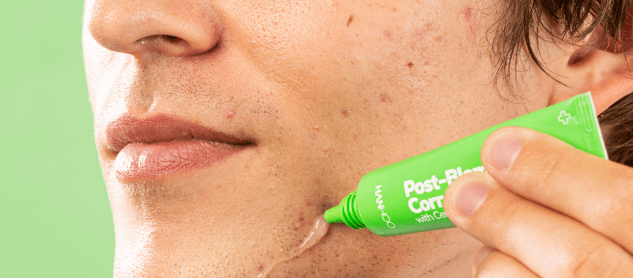 Post Blemish Corrector 101 – hanhoousa