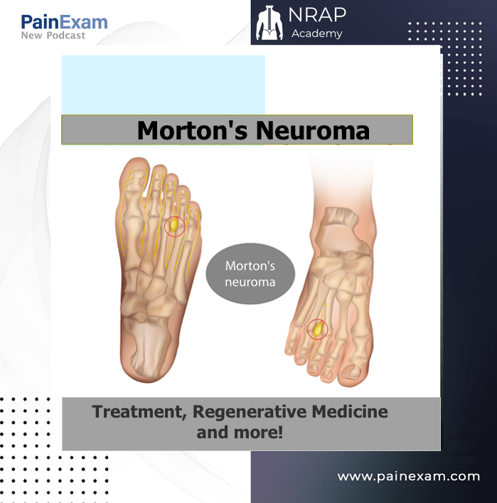 Mortons Neuroma Treating Morton's Neuroma: Surgery To Save The Nerve