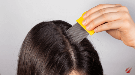 Say Goodbye to Lice: Effective Strategies to Eliminate Lice Infestations