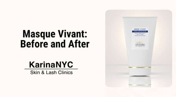 Masque Vivant Before and After: Clearer Skin Fast – KarinaNYC